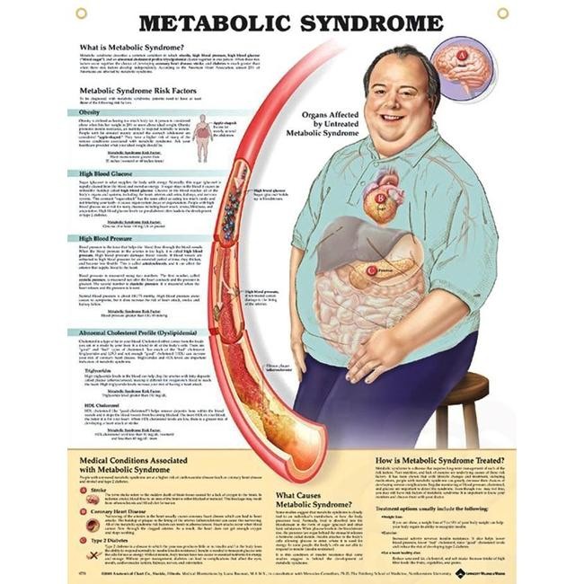Jual POSTER SISTEM METABOLISME METABOLIC SYNDROME - A3+ Artpaper ...