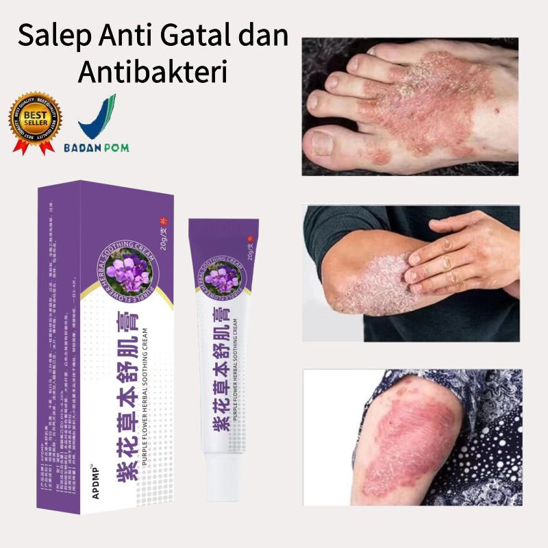 Jual Gatal paling ampuh Formula botani alami tanpa efek samping Salep ...