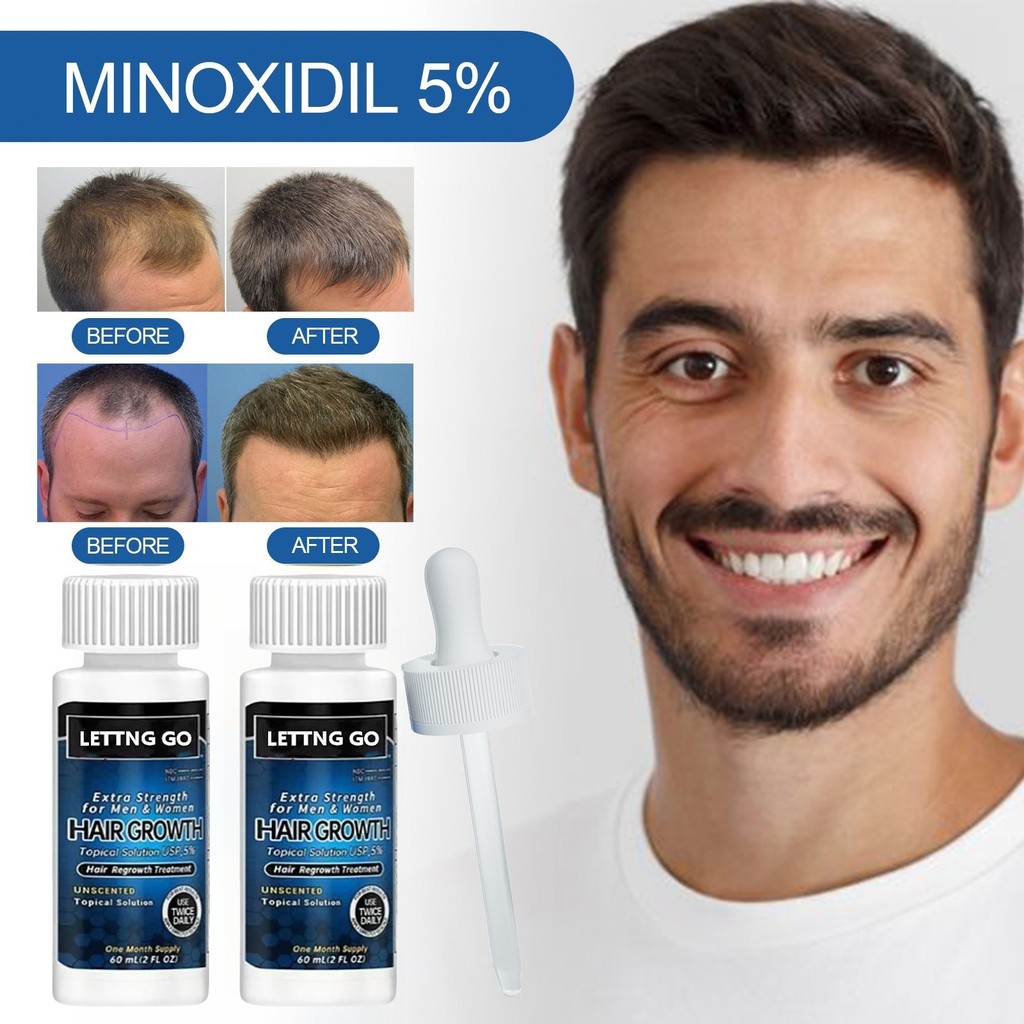 Jual ORIGINAL MINOXIDIL STRANDS Hair regrowth treatment - 5% Minoxidil ...