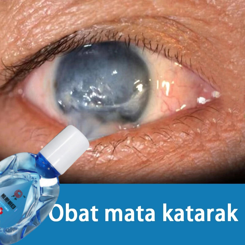 Jual Obat mata obat mata katarak obat tetes mata Mata kering Sakit mata ...