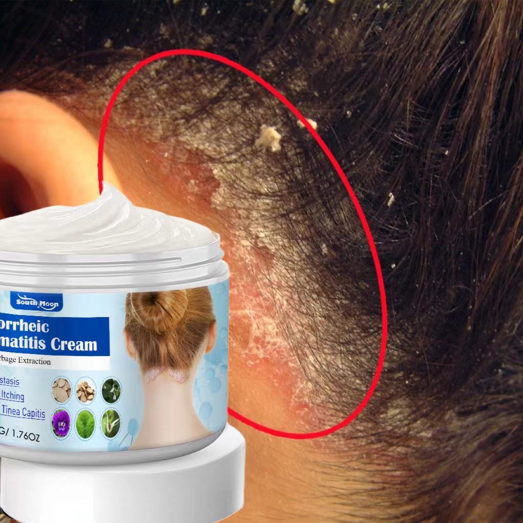 Jual Obat Dermatitis Seboroik, Obat Cradle Cap, Obat Ketombe Berkerak, Obat Ketombe Rambut, Obat ...