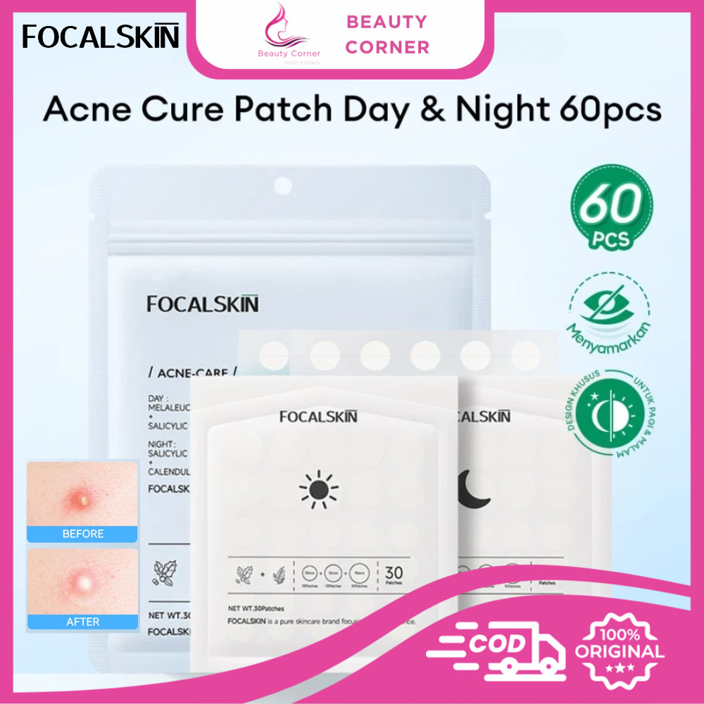 Jual Focalskin Acne Pimple Patch Day & Night - 60Patch | Shopee Indonesia