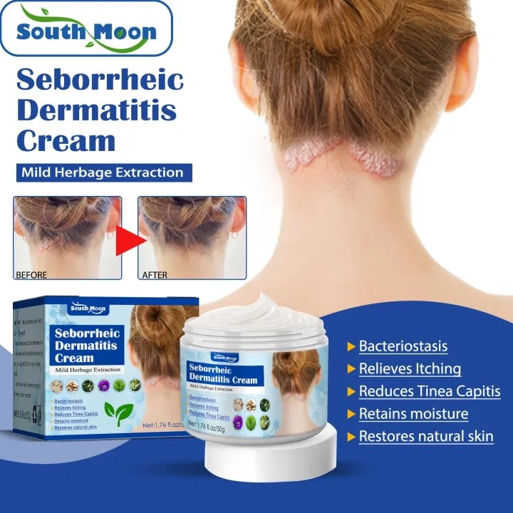 Jual Seborrheic Dermatitis Cream 50g Krim Kulit Gatal Non-iritasi Sehat ...