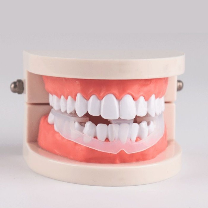 Jual Dental Mouth Guard Bruxism Splint Night Teeth Tooth Grinding Sleep ...