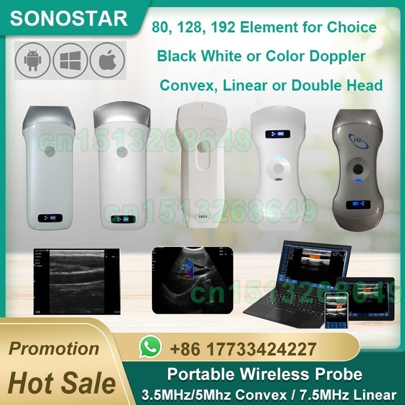 Jual wireless ultrasound probe Portable Wifi Probe Convex / Linear ...