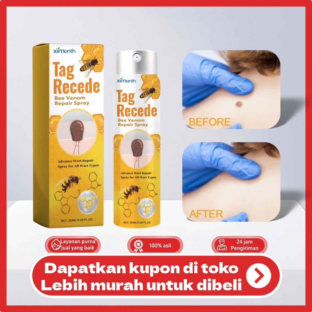 Jual Ximonth 20ml Bee Venom Treatment/Kutil Dan Tahi Lalat Obat Kutil ...