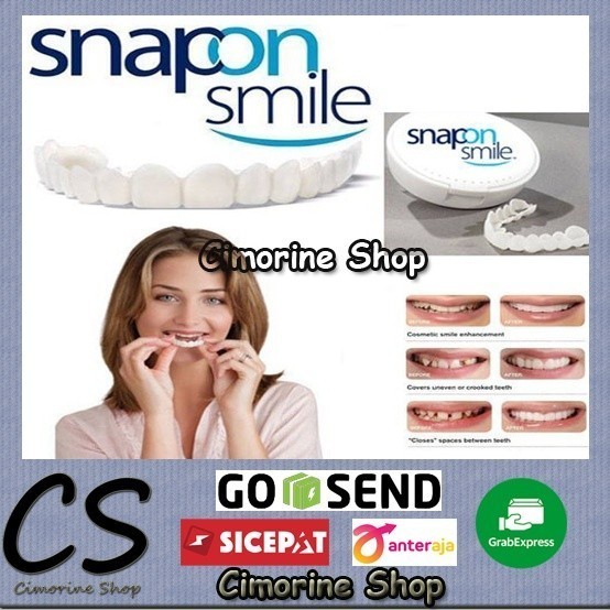Jual SnapOn Smile Denture Elastic Removable Veneer Teeth Gigi Palsu | Shopee Indonesia