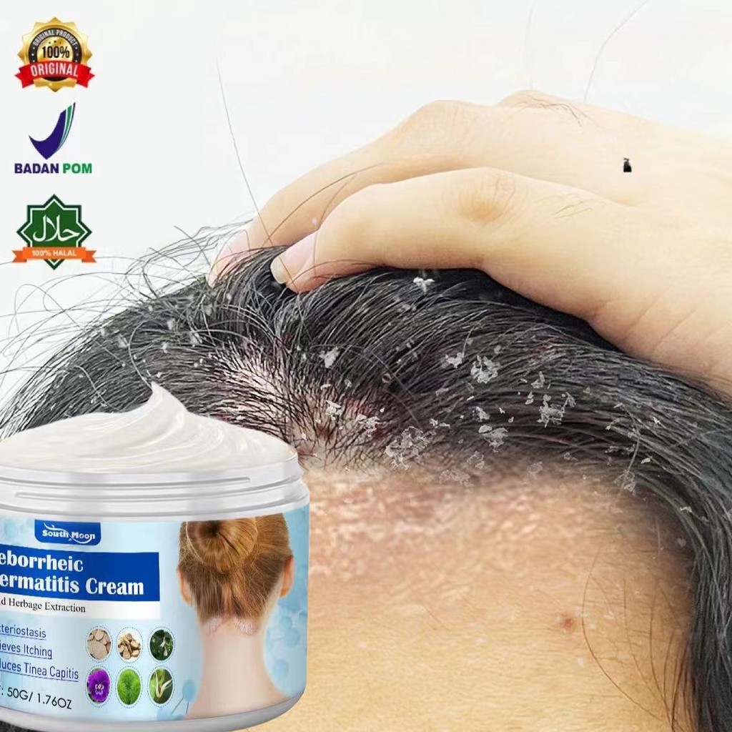 Jual OBAT KETOMBE PARAH Scalp Itching dan Dandruff Rambut rontok Anti Ketombe cream | Shopee ...