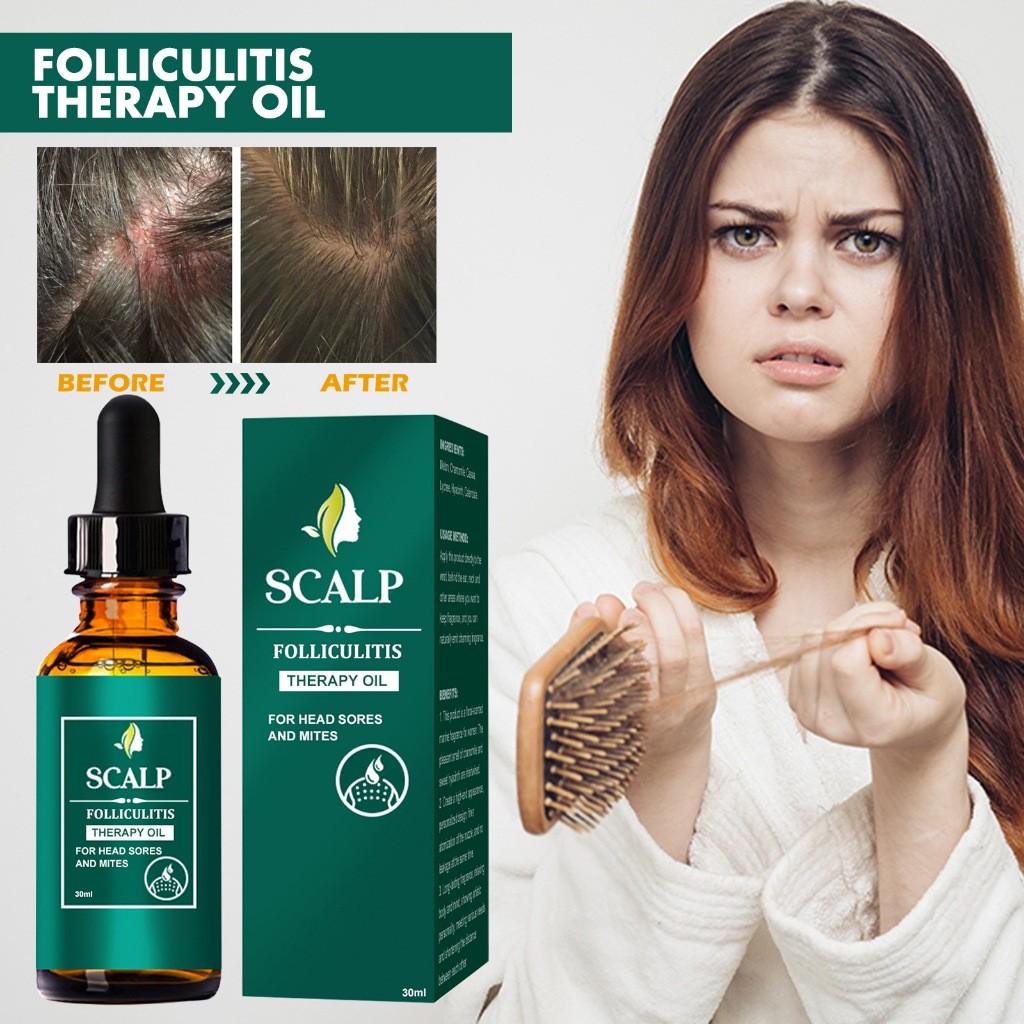 Jual EELHOE Scalp Folliculitis Therapy Oil 30ml Meredakan Gatal Pada ...