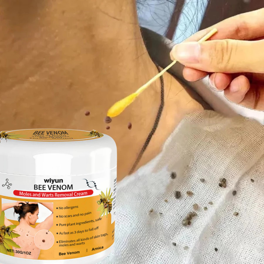 Jual Bee Venom Salep Obat Kutil Paling Wart Removal Cream Penghilang ...