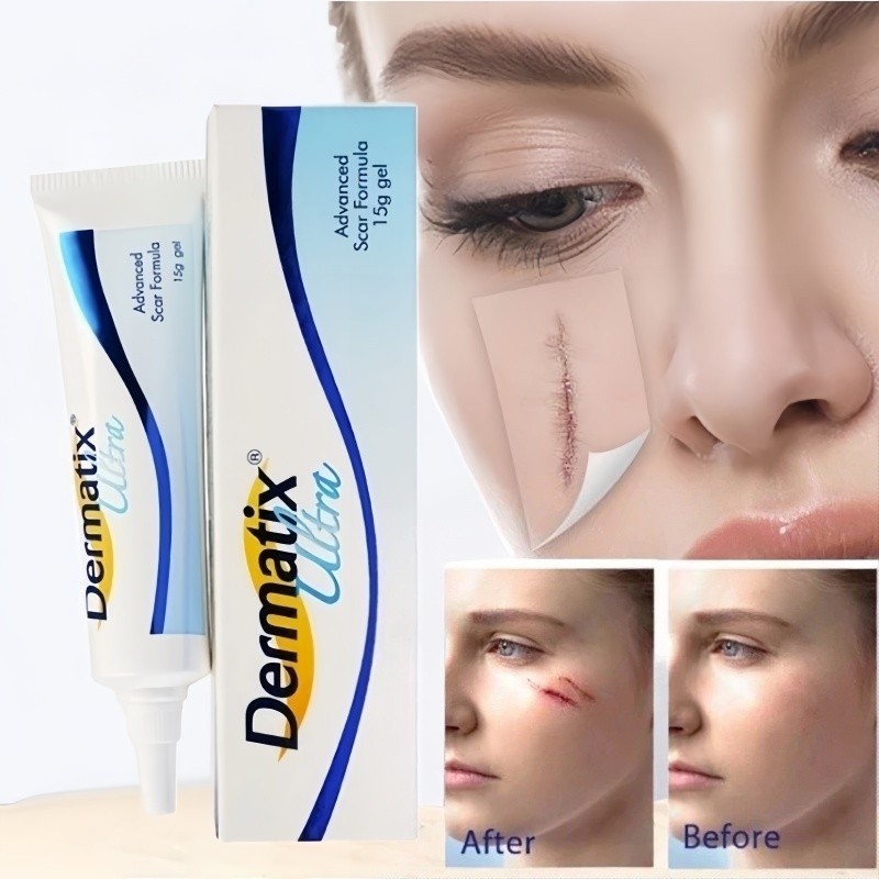 Jual [100% Asli asli EXP2027]Dermatix Ultra Gel 15gr Penghilang Bekas ...