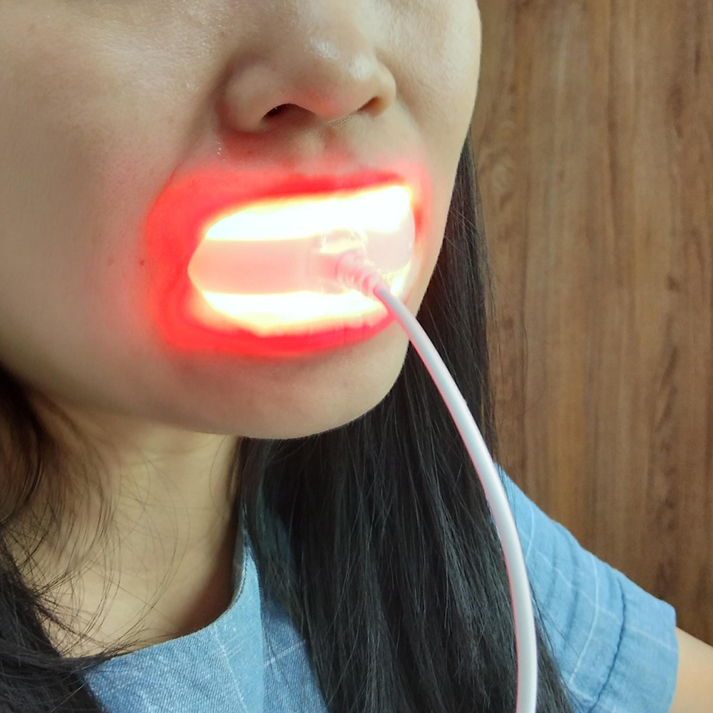 Jual Cold Sore Device Red Light Therapy For Mouth Sores Treatment Near ...