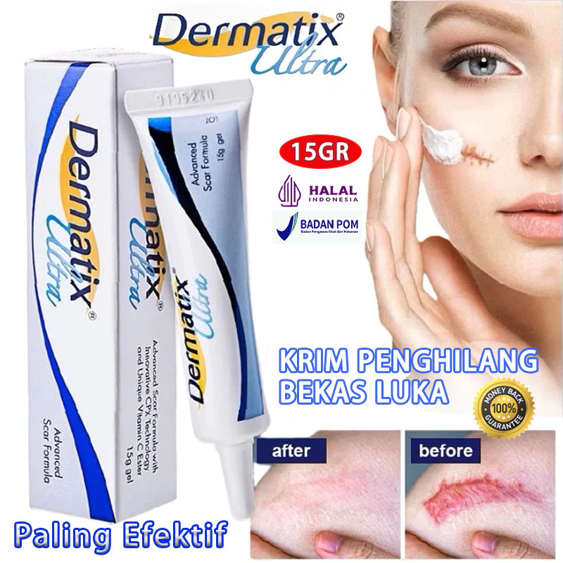 Jual Dermatix Ultra Advanced Scar Gel 15g Penghilang Bekas Luka Jerawat ...