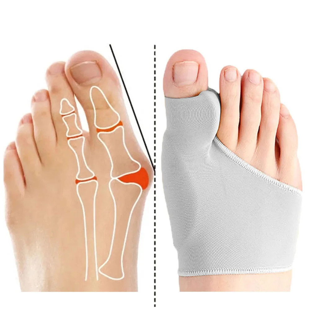 Jual Toe Separator Hallux Valgus Bunion Corrector Orthotics Feet Bone ...
