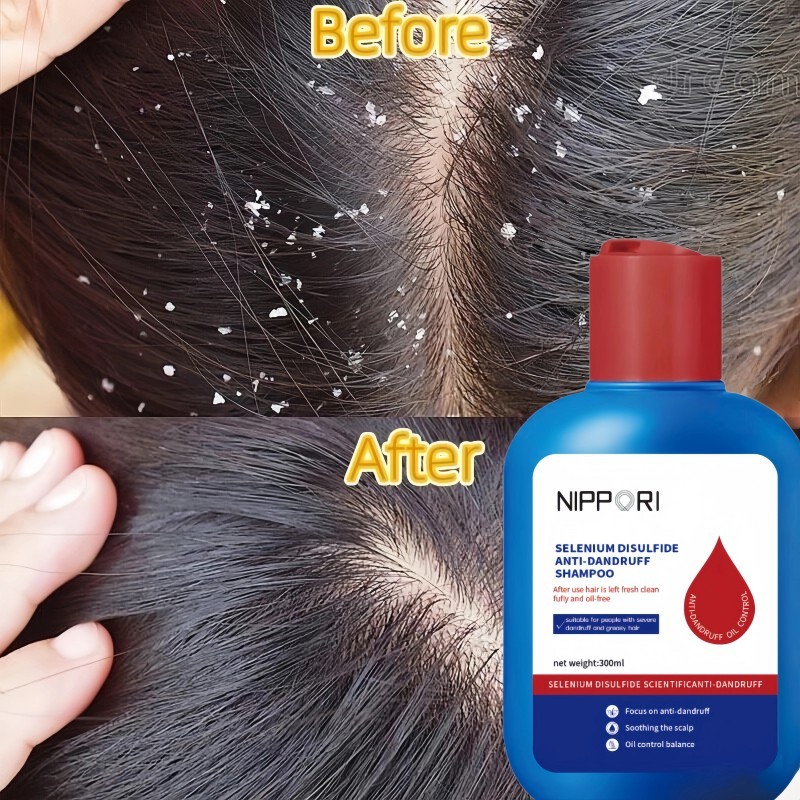 Jual NIPPORl Selenium Disulfide Shampoo Oil Control Anti-Dandruff Anti ...