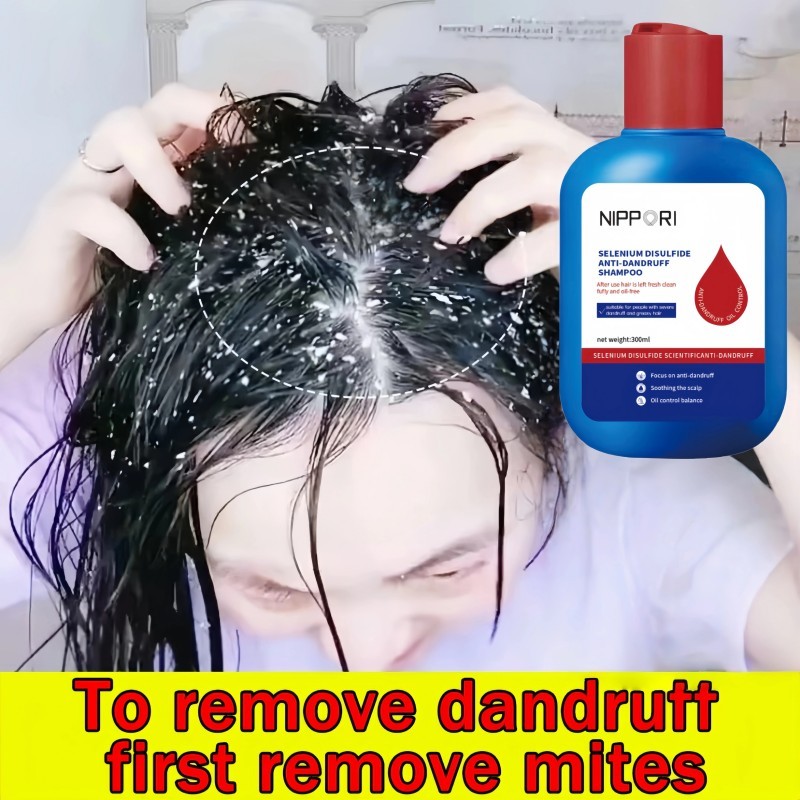 Jual Selenium Disulfide Shampoo Oil Control Anti-Dandruff Anti-Itch ...