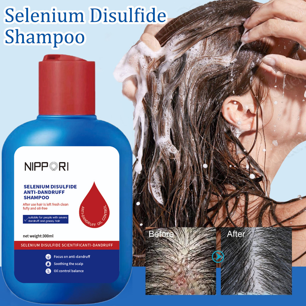 Jual 300Ml Selenium Disulfide Shampoo Oil Control Anti-Dandruff Anti ...