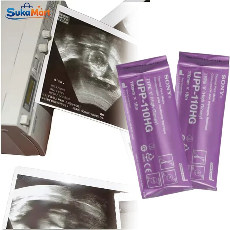 Jual Kertas USG Sony UPP 110 HG Kertas Thermal High Glossy untuk ...