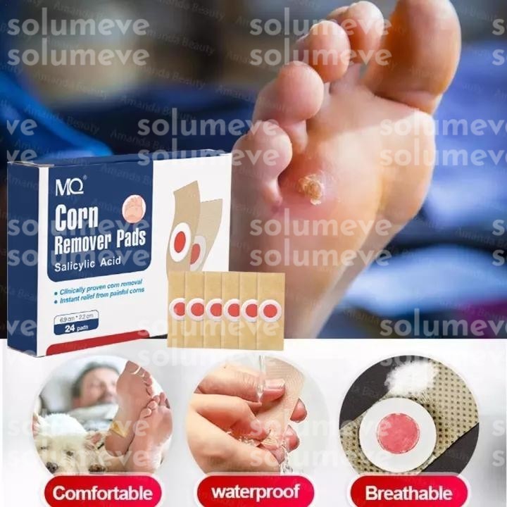 Jual 24Pcs Plester Obat Kutil & Mata Ikan – Foot Corn & Wart Removal ...
