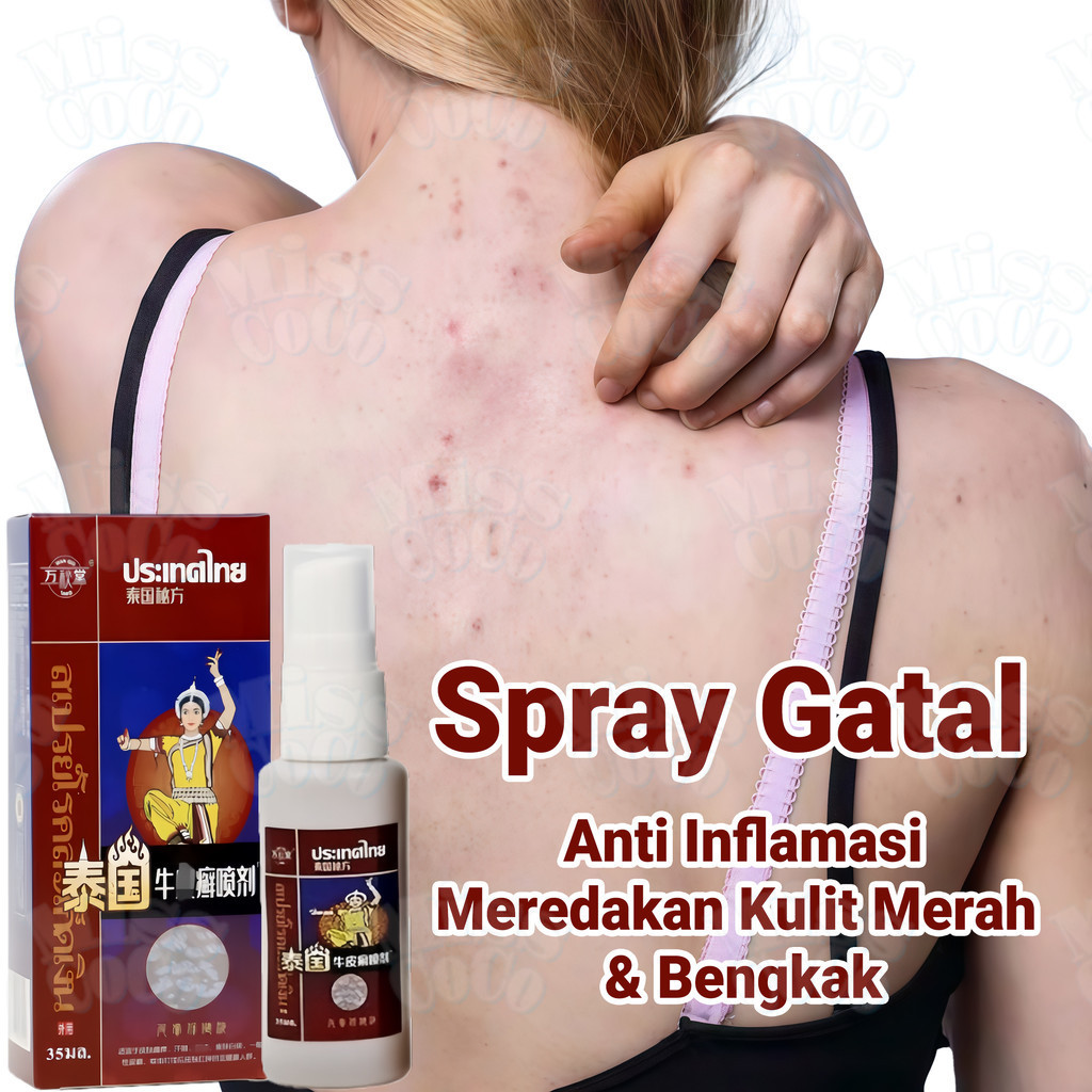 Jual Spray Gatal 35ml Pereda Gatal Paling Ampuh untuk Psoriasis, Eksim ...