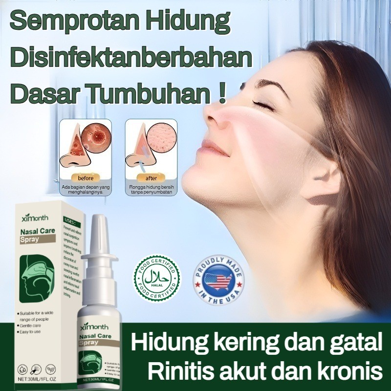 Jual [Solusi Alami] Nasal Spray untuk Meringankan Hidung Tersumbat dan ...