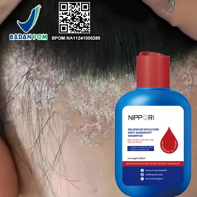 Jual NIPPORl Selenium Disulfide Shampoo Oil Control Anti-Dandruff Anti ...