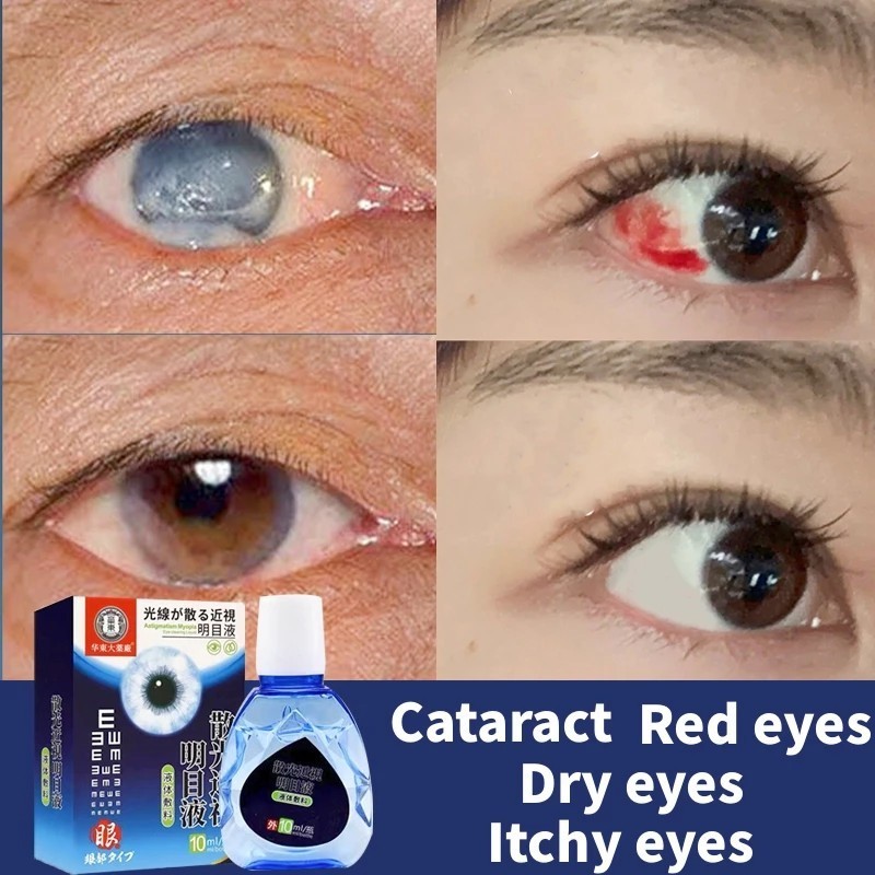 Jual Orionatrix Obat Tetes Mata Obat Mata Katarak Eye Drop Tetes Mata ...