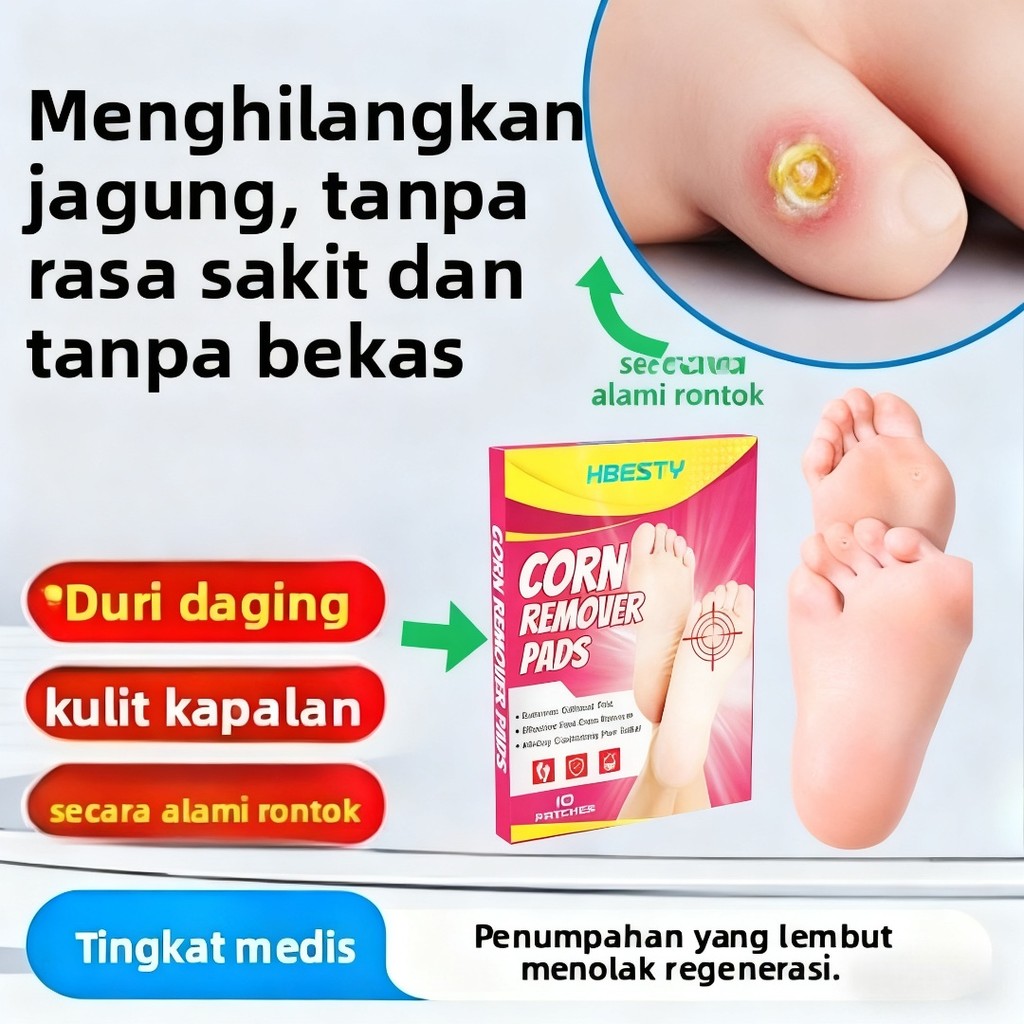 Jual Hancurkan Kutil dan Foot Corn dengan 10PCS HBESTY Plester Mata ...