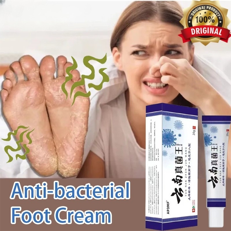Jual Obat Kaki Rayapan Dan Bau Penghilang Bau Kaki Obat Jamur Kaki Obat ...
