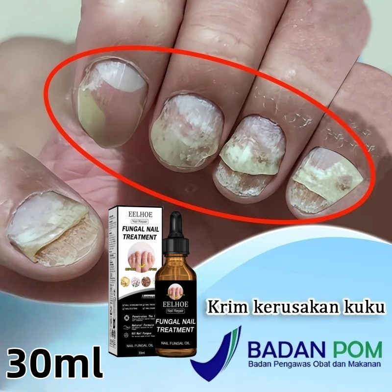 Jual Nail Growth Serum, Ginger Nail Serum, Nails Repair Cuticles Oil ...