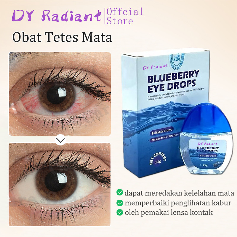Jual DY Radiant Blueberry Eye Drop Obat Tetes Mata Obat Mata Katarak ...