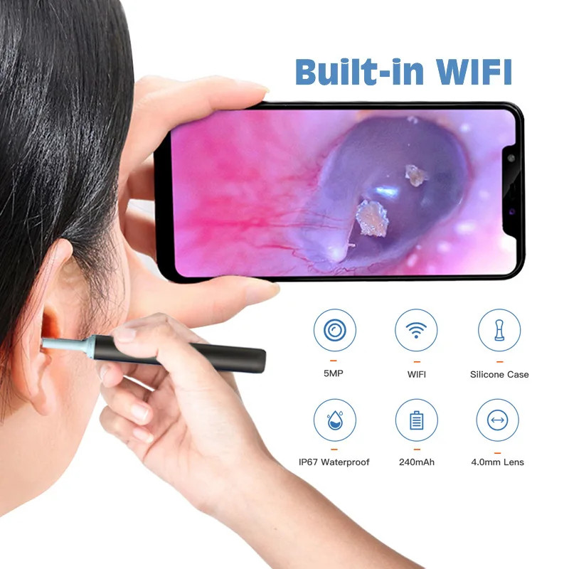 Jual 4.1mm IP67 5MP Earwax Video Endoscope Ear Pick Cleaner Cleaning ...