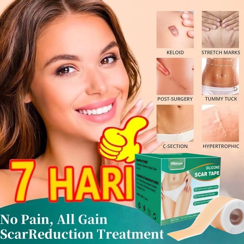 Jual Silicone Scar Sheet 4cm x 300cm plester Scar Removal Silicone Tape ...