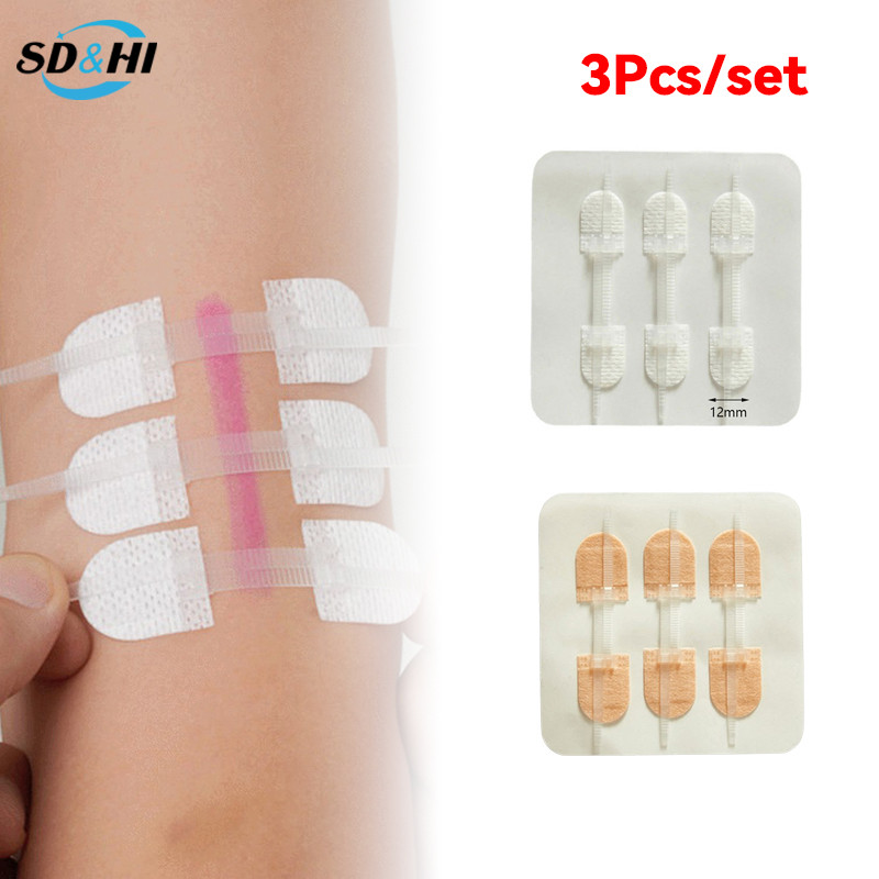 Jual Wound Skin Closure Strips Postpartum Wound Repair Cosmetic Surgery ...