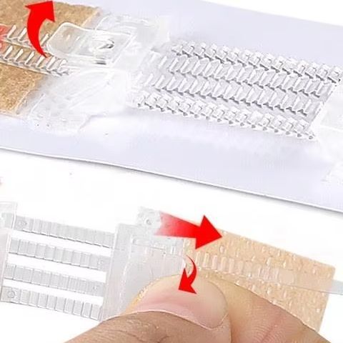 Jual Zipper Tie Wound Closure Patch Hemostatic Patch Wound Fast Without ...