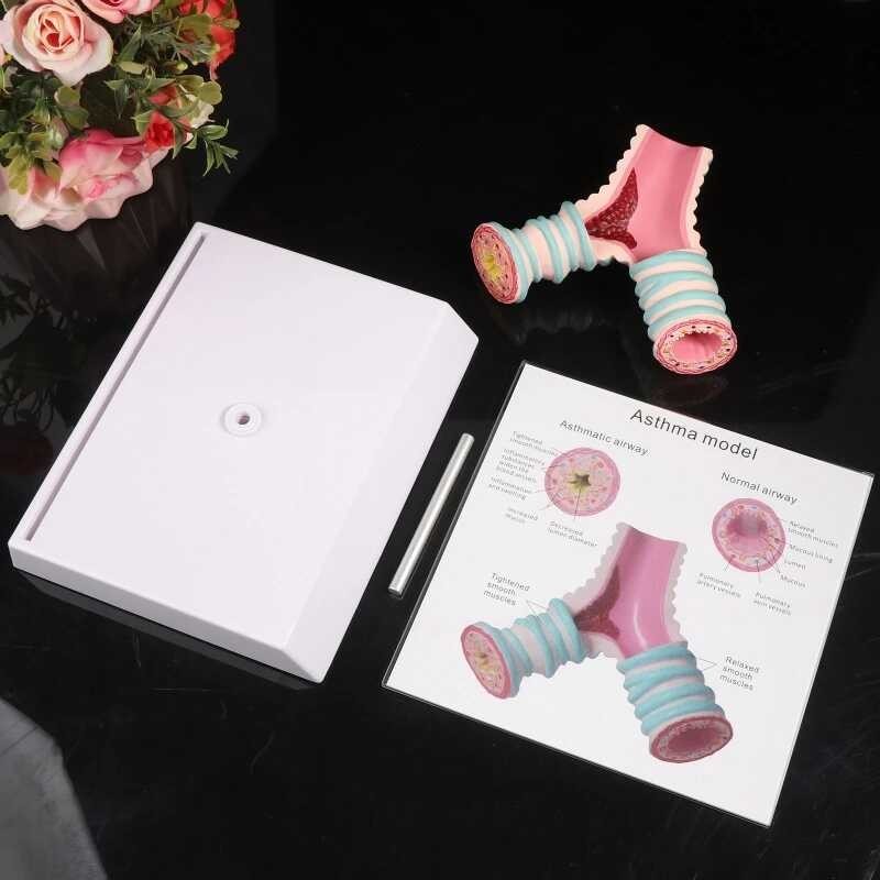 Jual ￥ Asma Model Perumpamaan Morbid Mengajar Dokter-Pasien Penjelasan ...