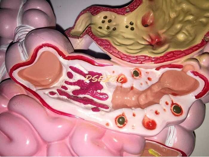 Jual ￥ Medical Human Digestive System Large Intestine Model Rectum ...