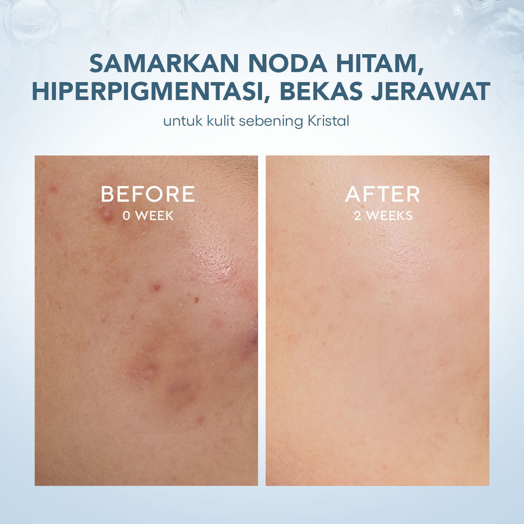 Jual Wardah 3% Tranexamic Acid + Alpha Arbutin Crystal Secret Dark Spot ...