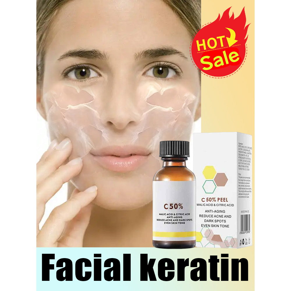 Jual Acid Peeling Serum Chemical Exfoliant Peel for remove Face Dark ...