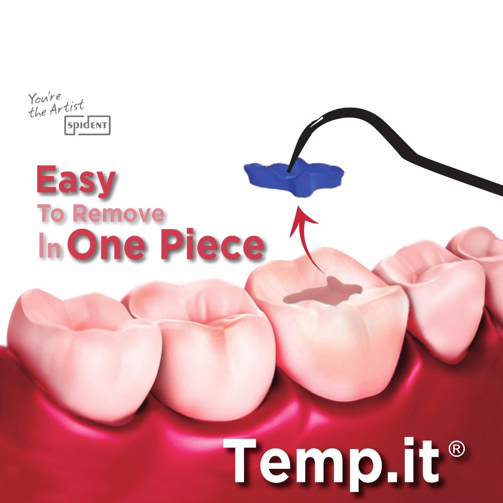 Jual Temp It Spident Light Curing Elastic Composite Resin In Out Lay ...