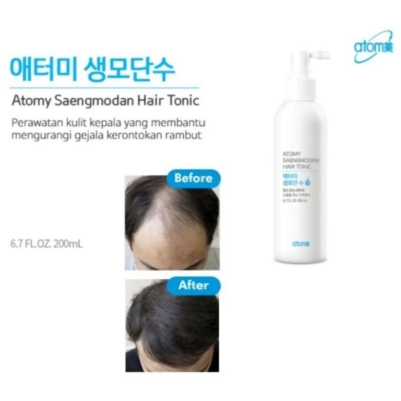 Jual Atomy Hair tonic saengmodan Perangsang tumbuh Rambut cepat ...
