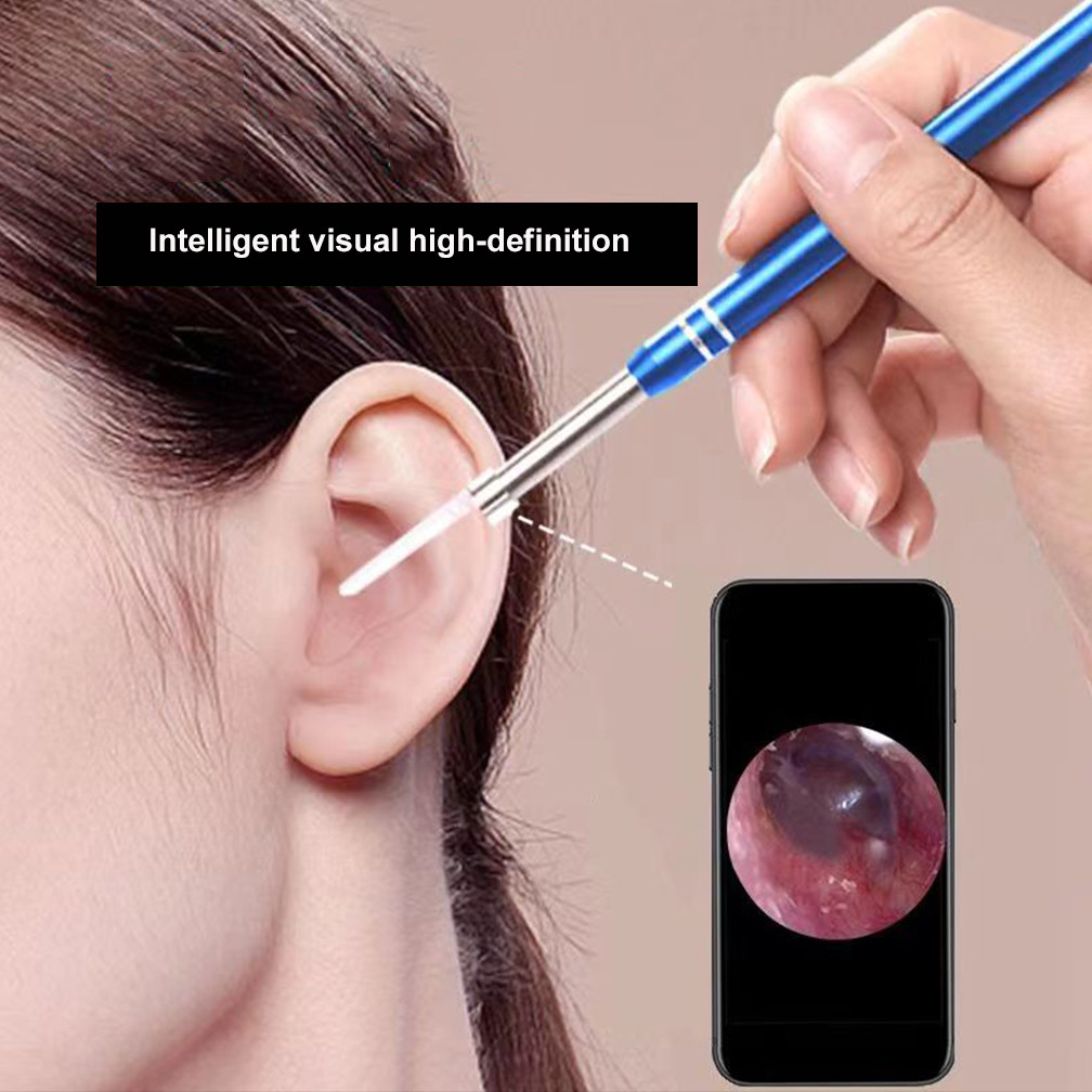 Jual Usb Phone Ear Otoscope Scope Inspection Camera 3In1 Ear Digital ...