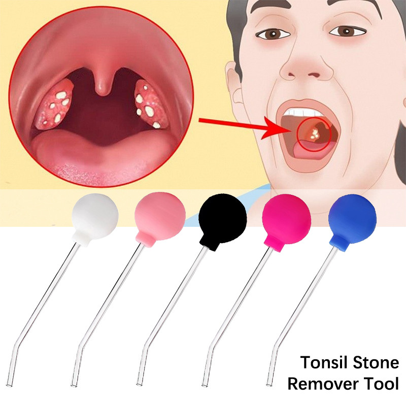 Jual Tonsil Stone Remover Tool Manual Style Remover Mouth Cleaning Care ...