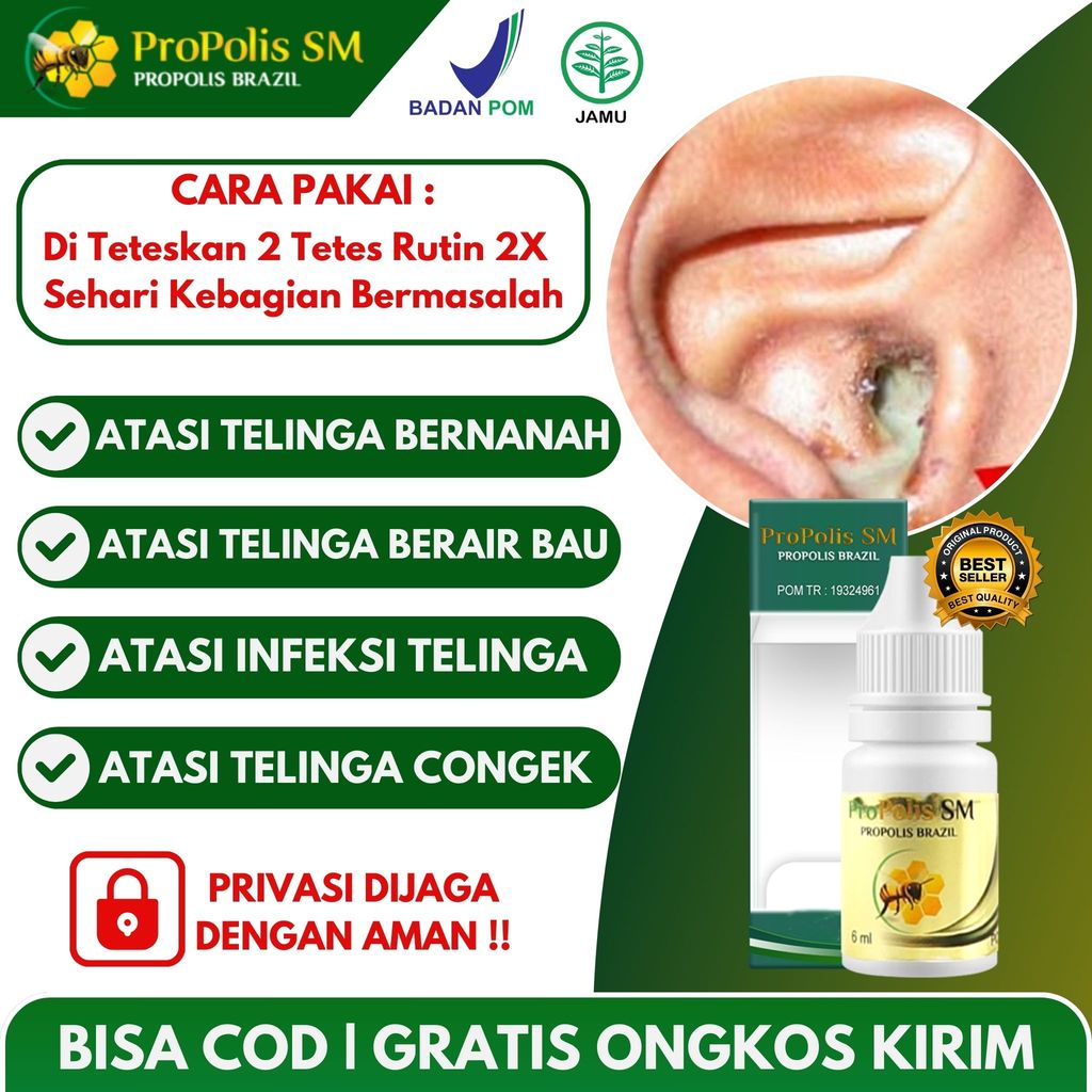 Jual Obat Tetes Telinga Sakit Telinga Gatal Berair Congek Berdengung ...